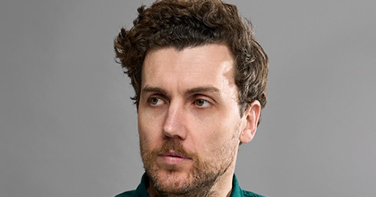 Daniel Connell is Always Sore | Off The Leash